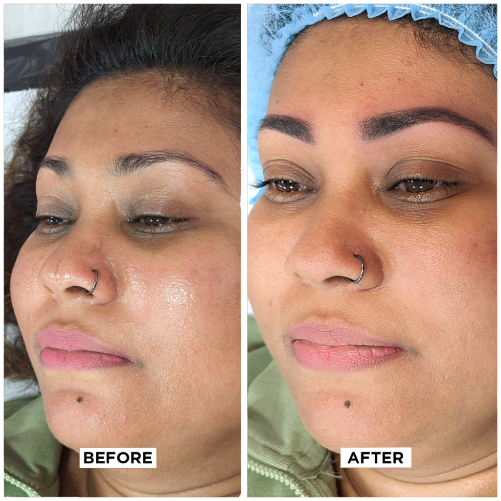 Ombre Eyebrows Healing Process: Day-by-Day Stages - Microblading