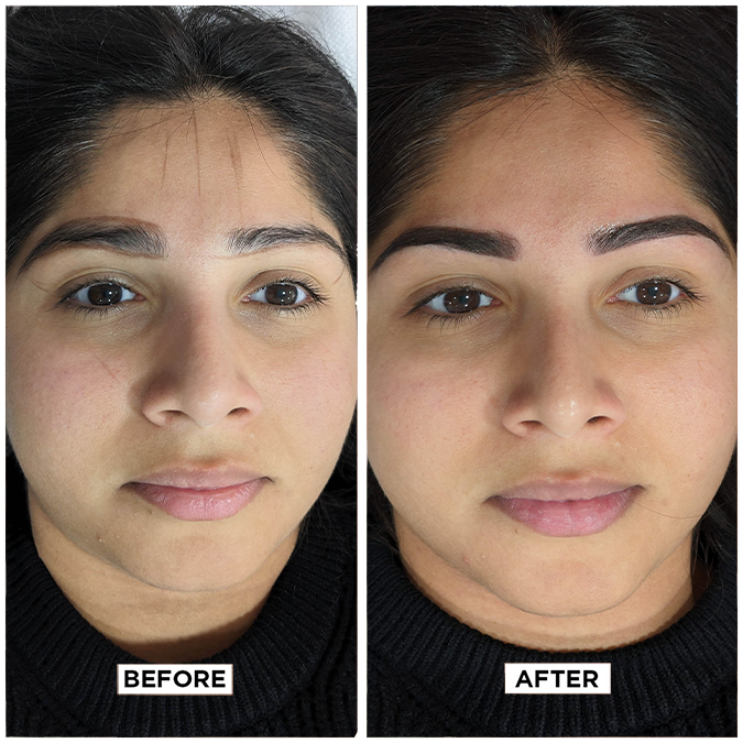 Have The Best Brows Every Day With This New Brow Technique - Microblading